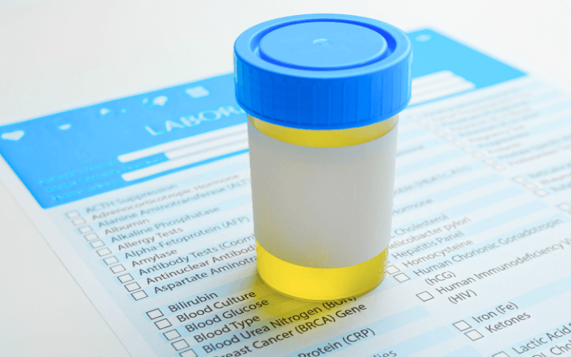 What to do After a Non-negative Drug Test Result?